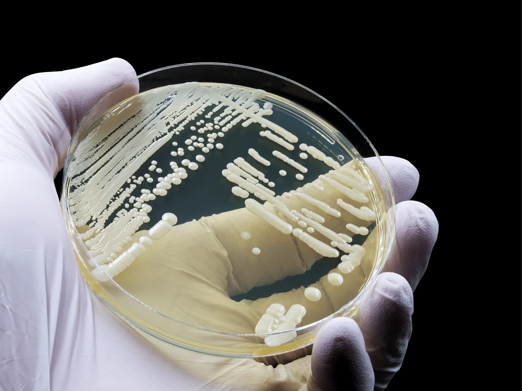 Under the Microscope - Candida auris in Focus